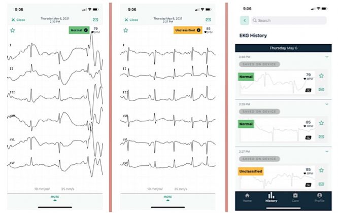 KardiaMobile personal EKG monitors review | Best Buy Blog